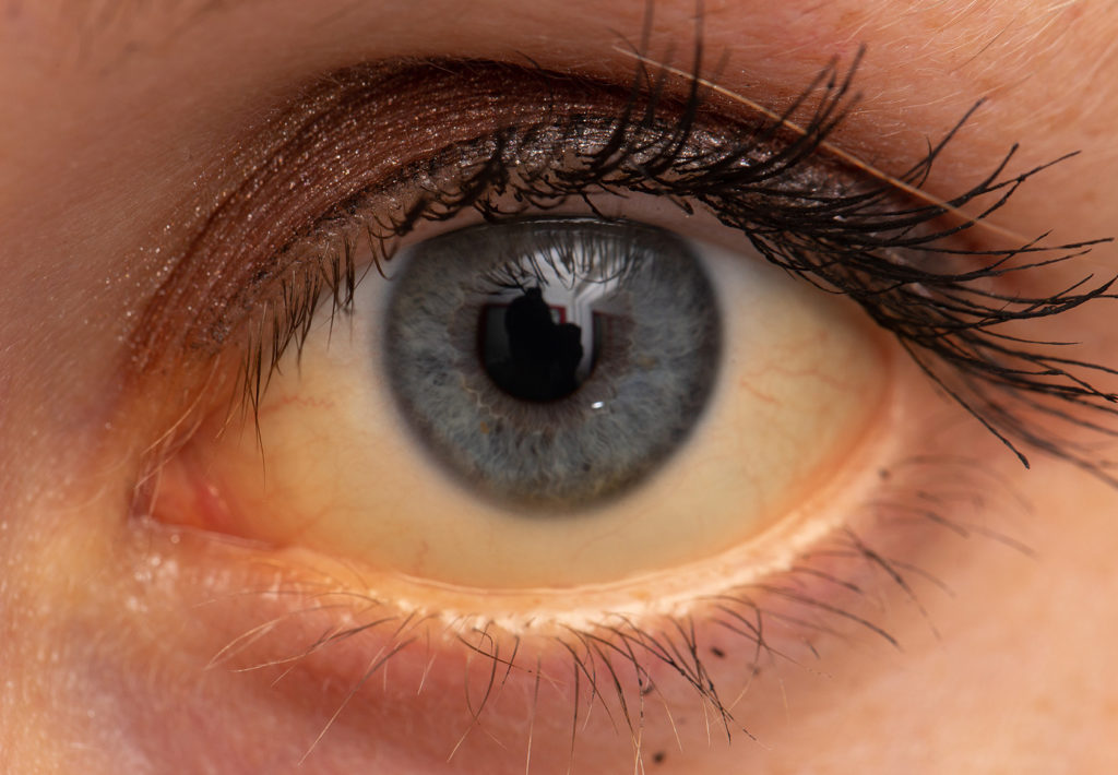 Hepatitis | tirol kliniken Blog